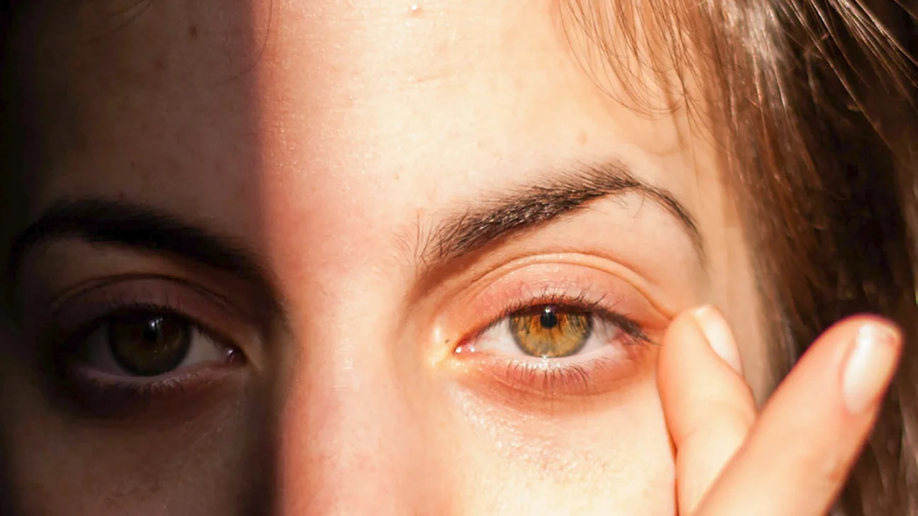 If your eye starts twitching and jumping…this is what it means and it’s ...
