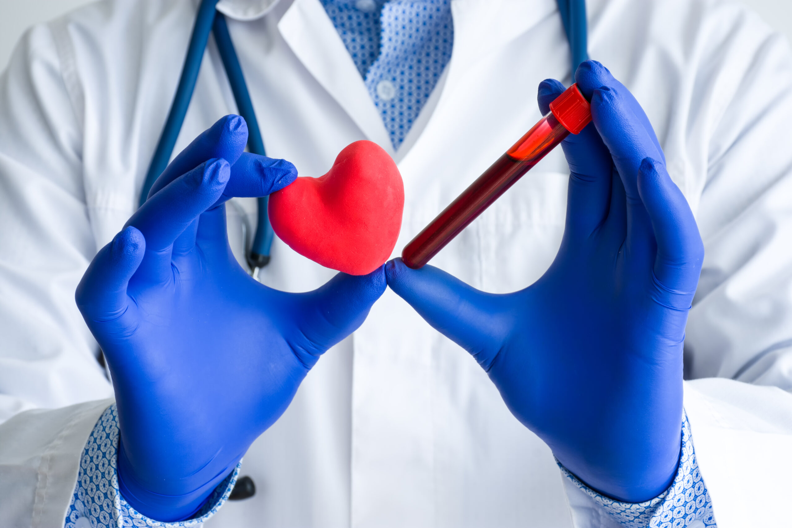 10 Early Warning Signs Of High Cholesterol Levels Health Care 10-early-warning-signs-of-high-cholesterol-levels-health-care